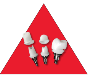 Dental Lab Implants Services by Trident Labs