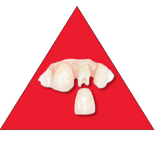 Dental Lab Implants Services by Trident Labs