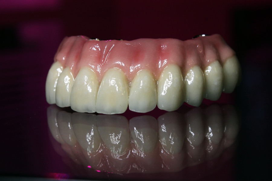 Zirconia Crowns - Trident Dental Lab